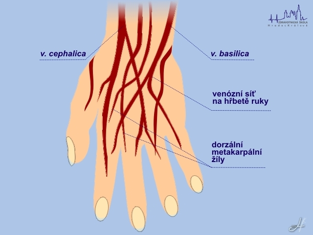Multimediální trenažer plánování ošetřovatleské péče